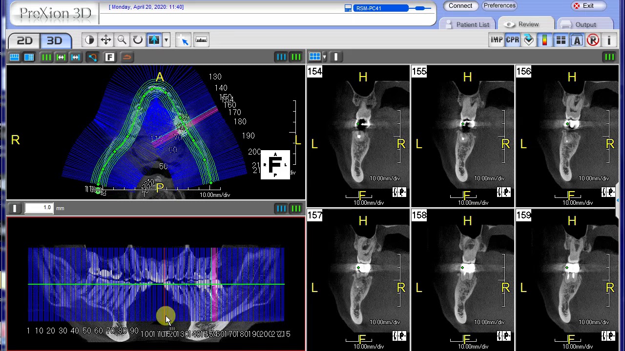 Prexion Training Tips Cross Sections And Panoramic Generated From Cpr