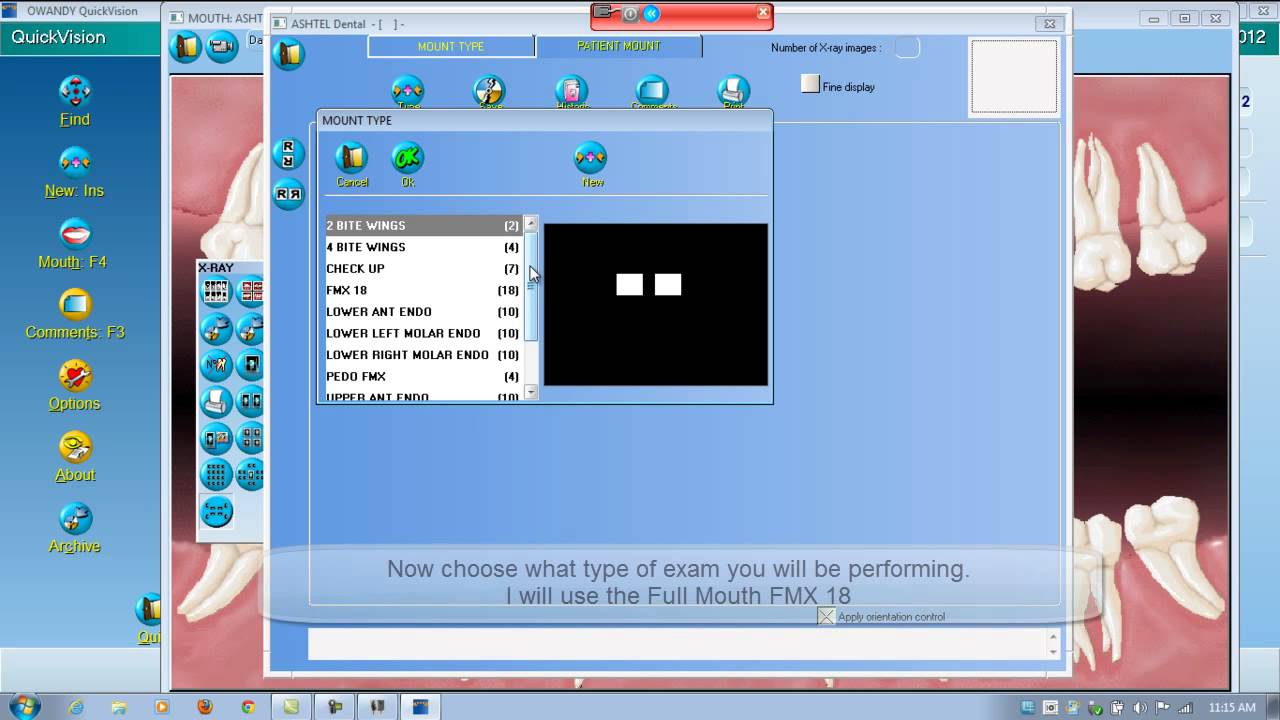 Entering Patients In Quickvision Youtube