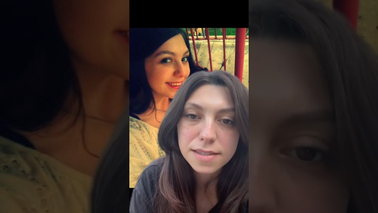 Part 3 How I Lost My Teeth And Got Dentures At 20 Years Old