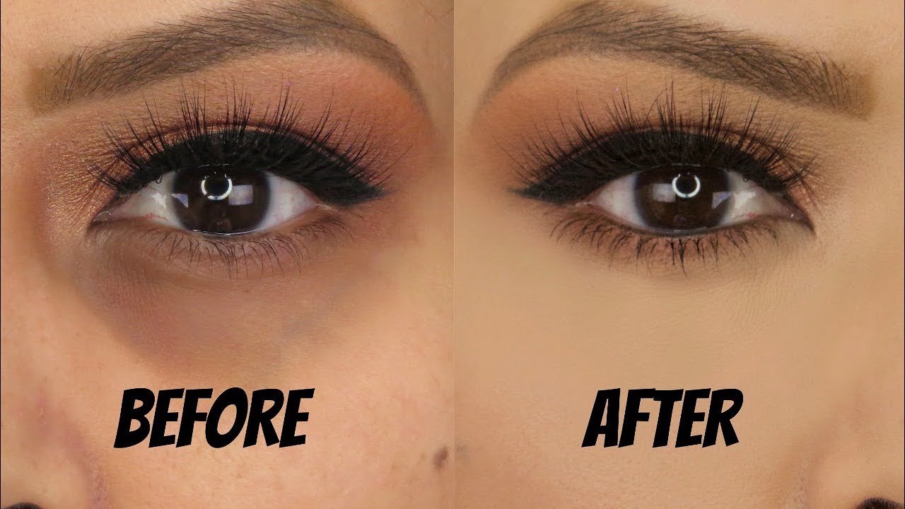 Best Makeup For Dark Under Eye Circles Saubhaya Makeup