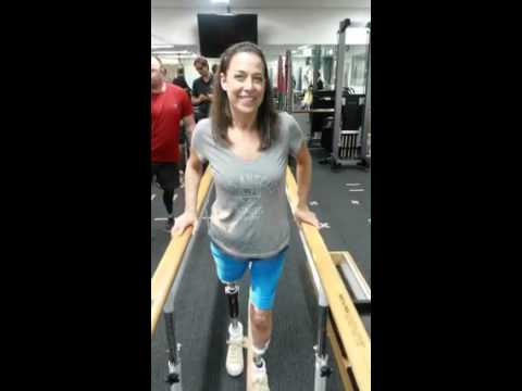 Akbk Amputee Youtube