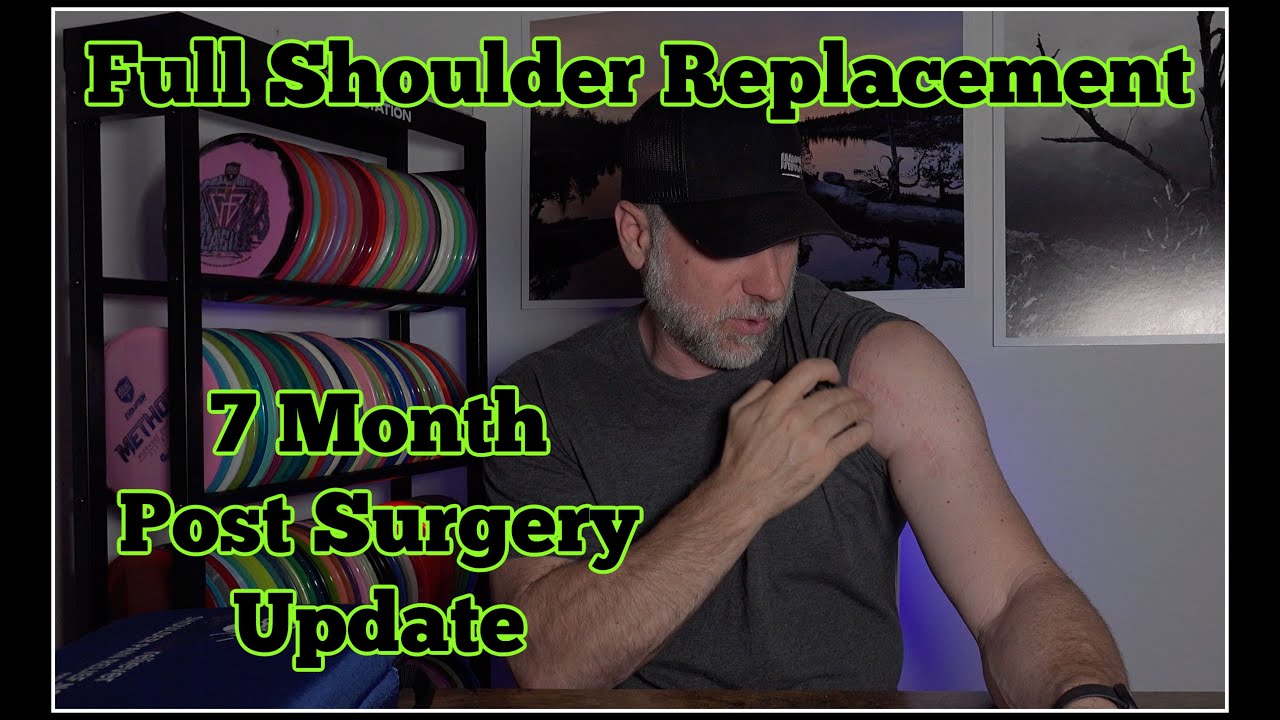 Full Shoulder Replacement 7 Month Post Surgery Update Youtube