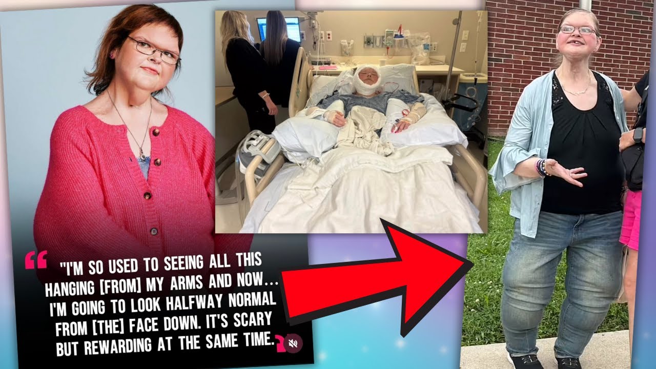 Tammy Slaton Reveals Stunning Transformation After Skin Removal Surgery