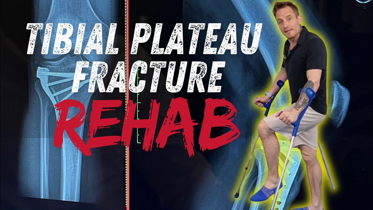 Tibial Plateau Fracture Recovery Scar Massage Weight Bearing