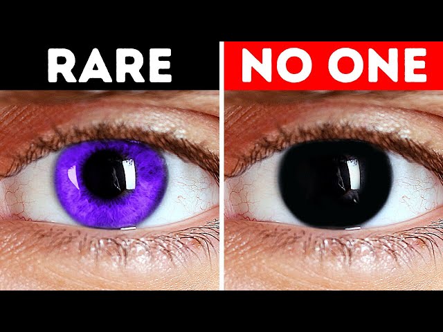 Violet Eyes In Humans Baby Eyes Changing Color The Surprising Truth
