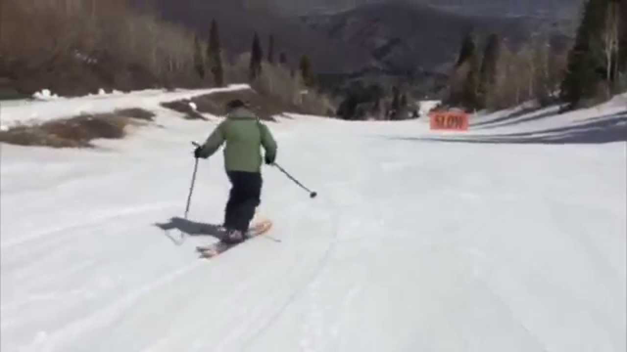 Kinematic Alignment Salt Lake City Total Knee Arthroplasty Ogden Ut