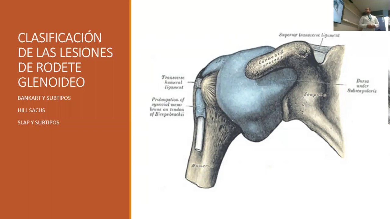 Lesiones De Rodete Glenoideo Youtube