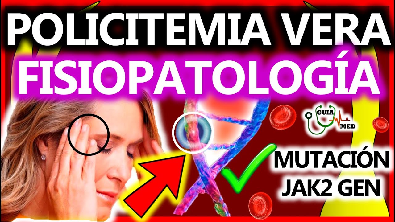 Policitemia Vera Fisiopatología Guiamed Youtube