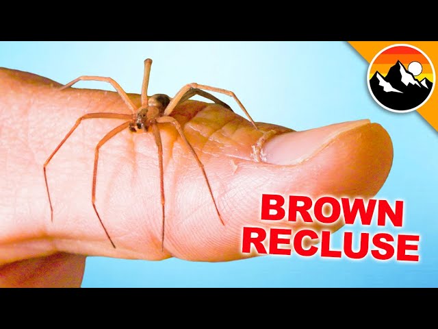 Will It Bite Me Handling A Brown Recluse Au7ocmnna30