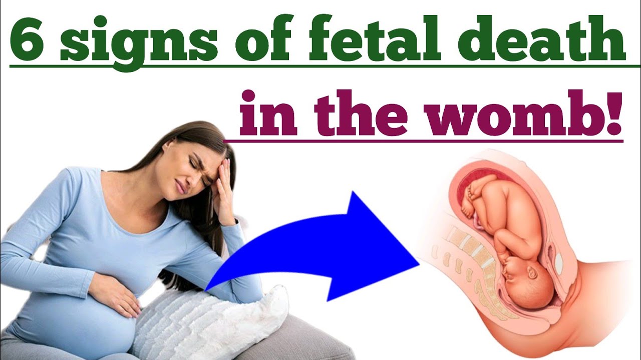6 Signs Of Fetal Death In The Womb And How To Prevent It Stillbirth
