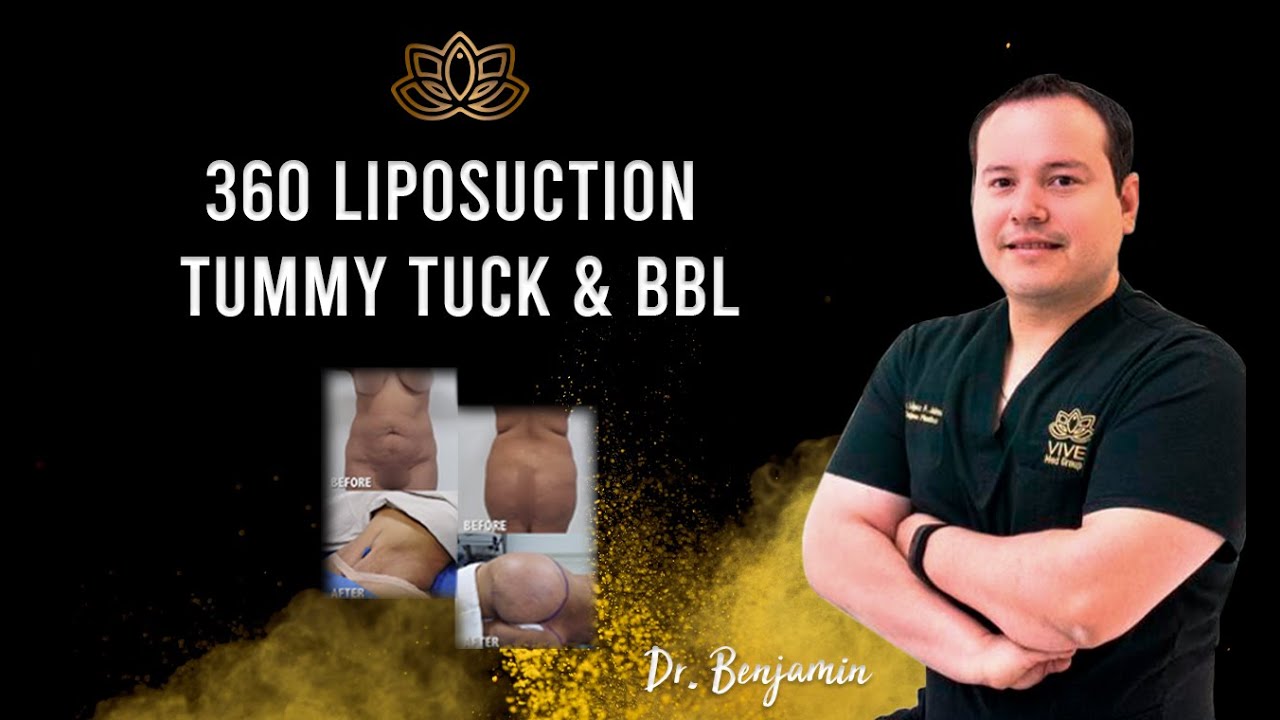 Difference Between Liposuction And Tummy Tuck Neryblu