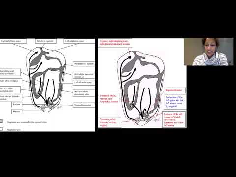 Retained Products Of Conception Or Uterine Avm Dr Aarti Sekhar Youtube