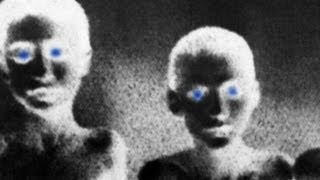 Josef Mengele Experiments On Eyes A Woman And Her Identical Twin Were