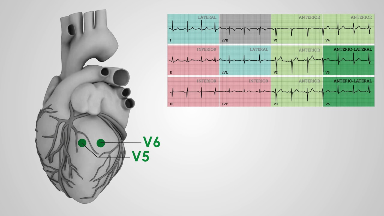 Electrical Vectors 12 Lead Ecg Placement Around The Heart Youtube