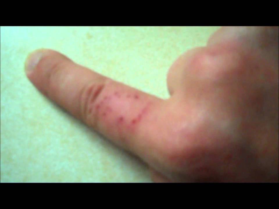 Ball Python Bite Youtube