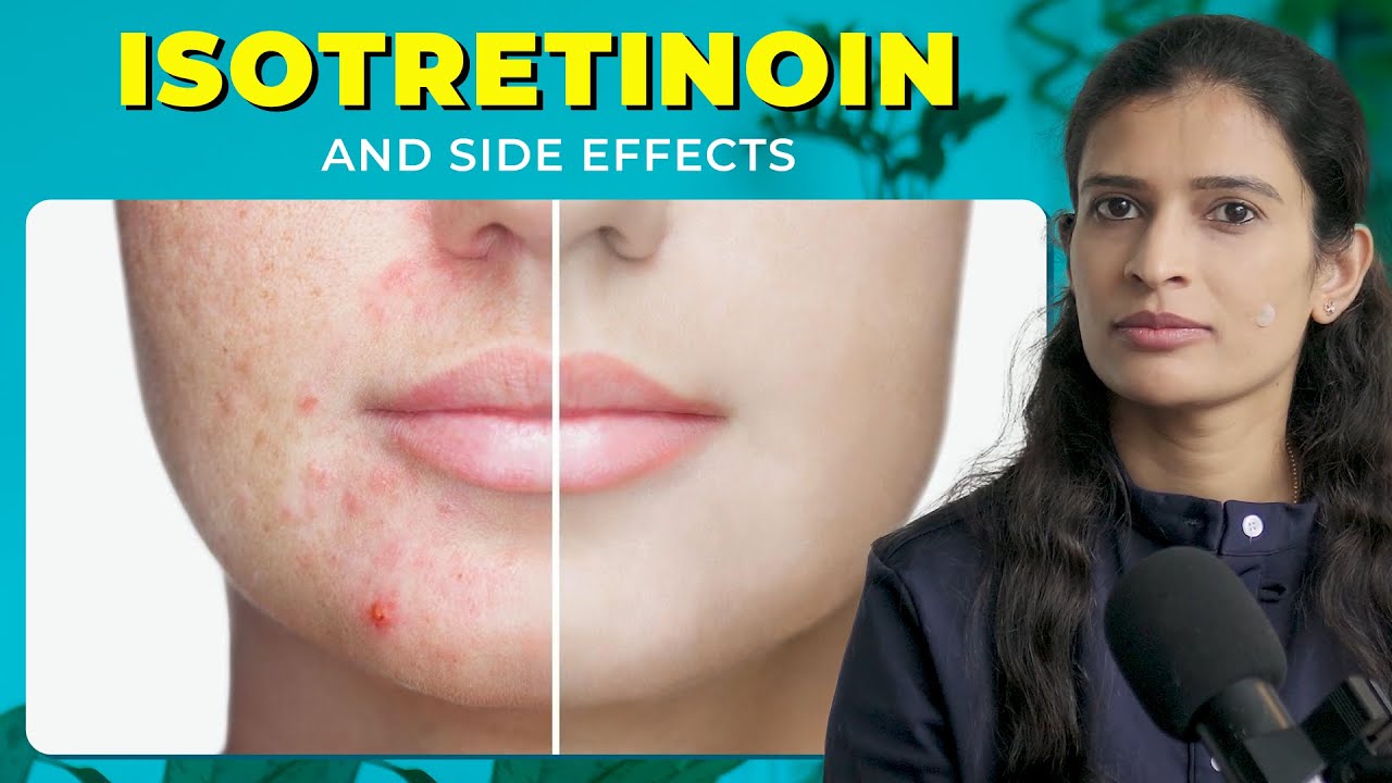 Isotretinoin Side Effects You Must Know Before Taking It Youtube