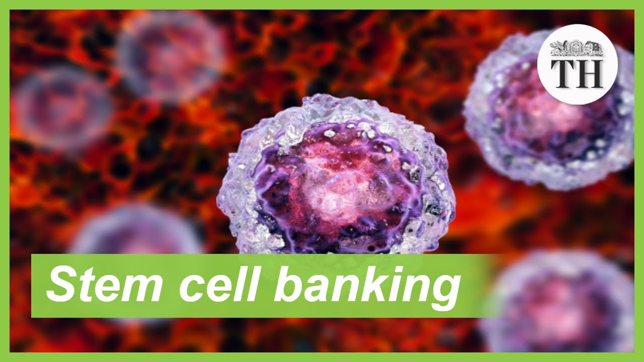 Automated Cell Banking At Wallace Yang Blog