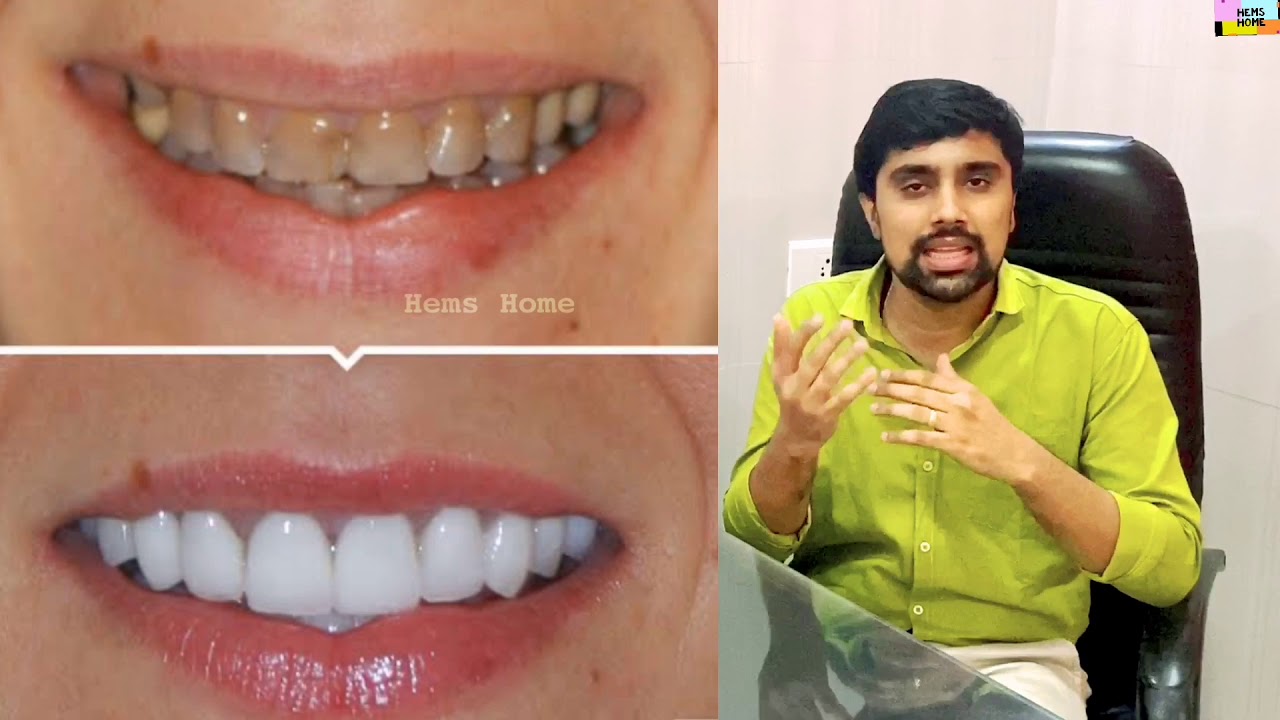Cosmetic Dentistry How To Close Gap Between Teeth Dental Braces