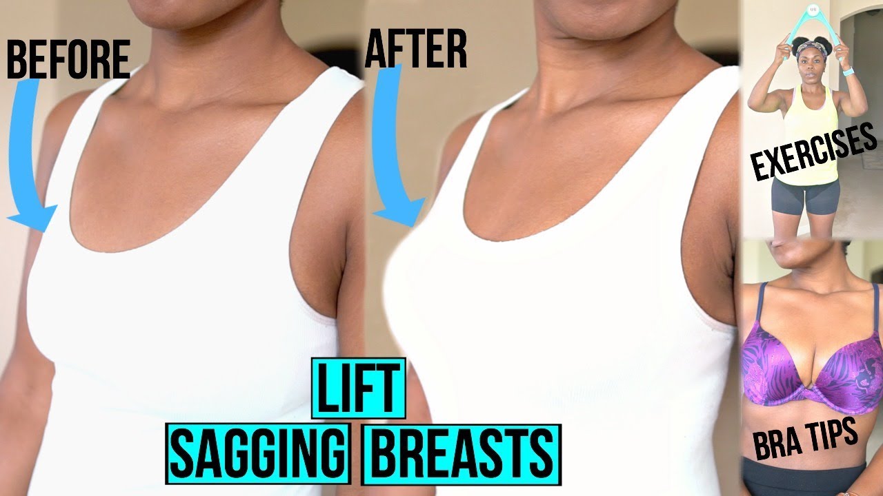 Please Help Is There Any Way To Non Surgically Lift Sagging Breasts