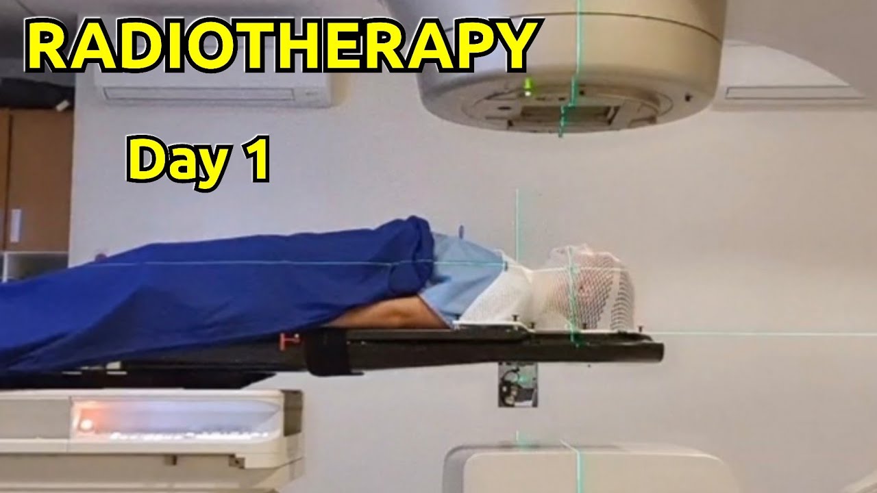 Radiation Therapy Radiotherapy Cancer Treatment Youtube