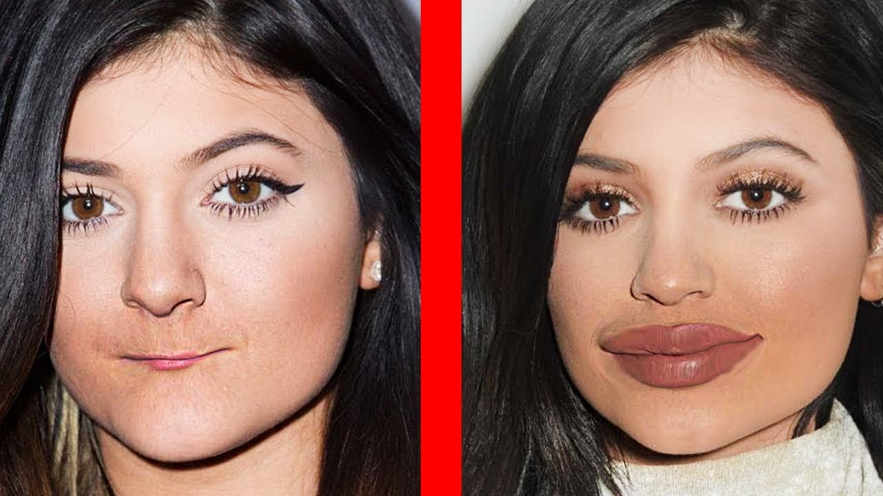 Before And After Plastic Surgery
