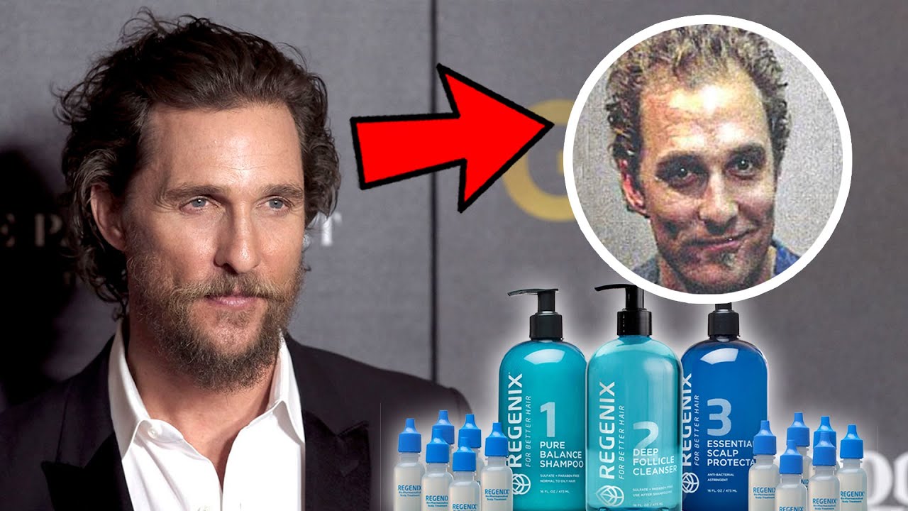Matthew Mcconaughey Dedicates His Hair Loss Reversal To This Miracle