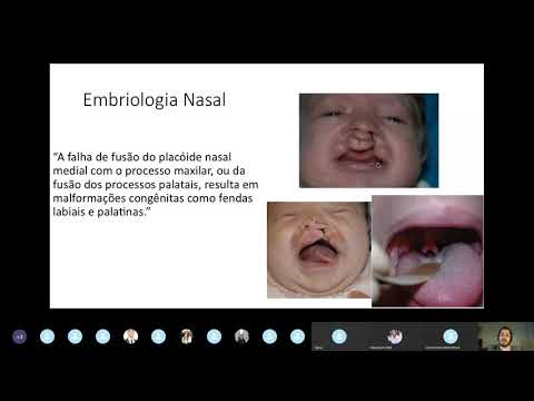 Atresia De Coana Malformações Congênitas Nasais E Fístula