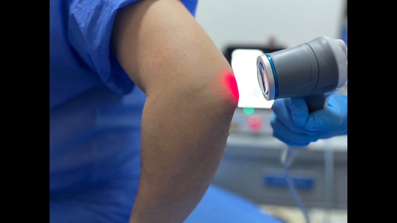 Terapia Lгўser Para Dolor De Codos Clг Nica Merced рџ вђќвљ пёџрџ ёвђќвљ пёџ Youtube