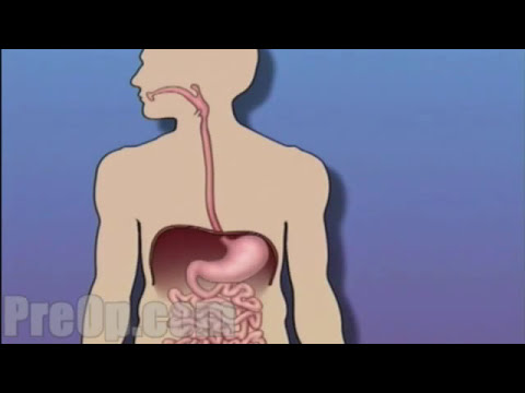Esophagogastroduodenoscopy Youtube