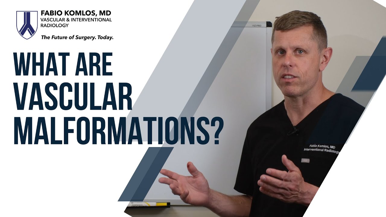 Vascular Malformations Explained Types Risks Minimally Invasive