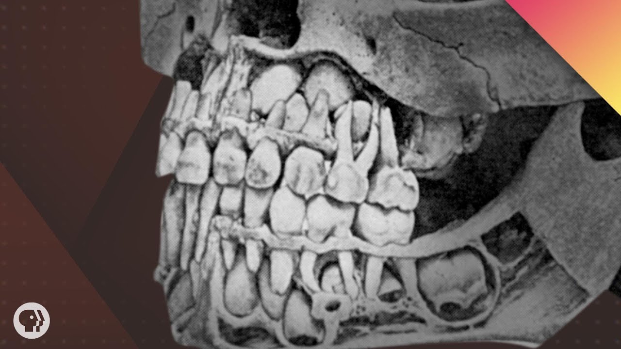Where Do Our Teeth Come From And Why Do We Have Two Sets