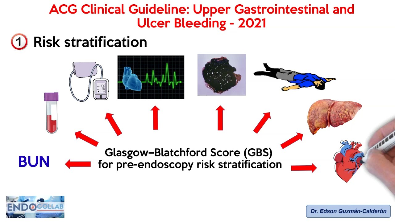 Risk Stratification In Upper Gi Bleeding Epomedicine