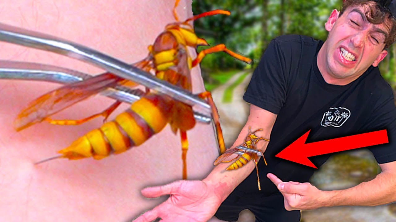 Stung By An Executioner Wasp 7 Times Youtube