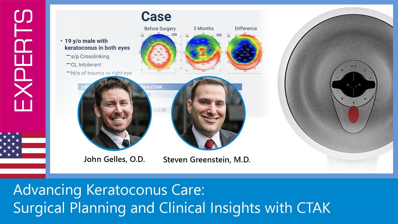 Advancing Keratoconus Care Surgical Planning And Clinical Insights