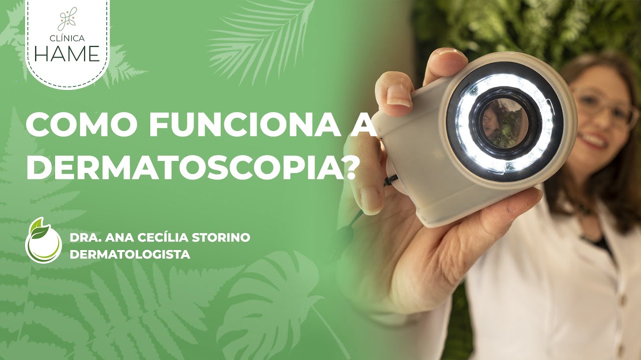 Como Funciona A Dermatoscopia Dói Dra Ana Cecília Storino Youtube