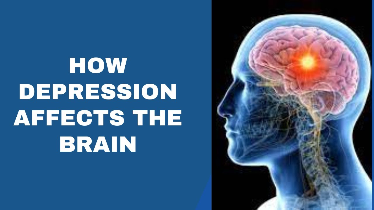 How Depression Affects The Brain Youtube