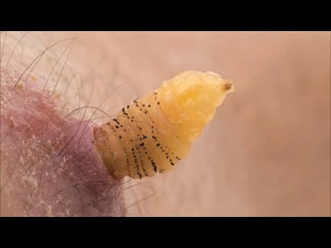 What Insects Lay Eggs Under Human Skin