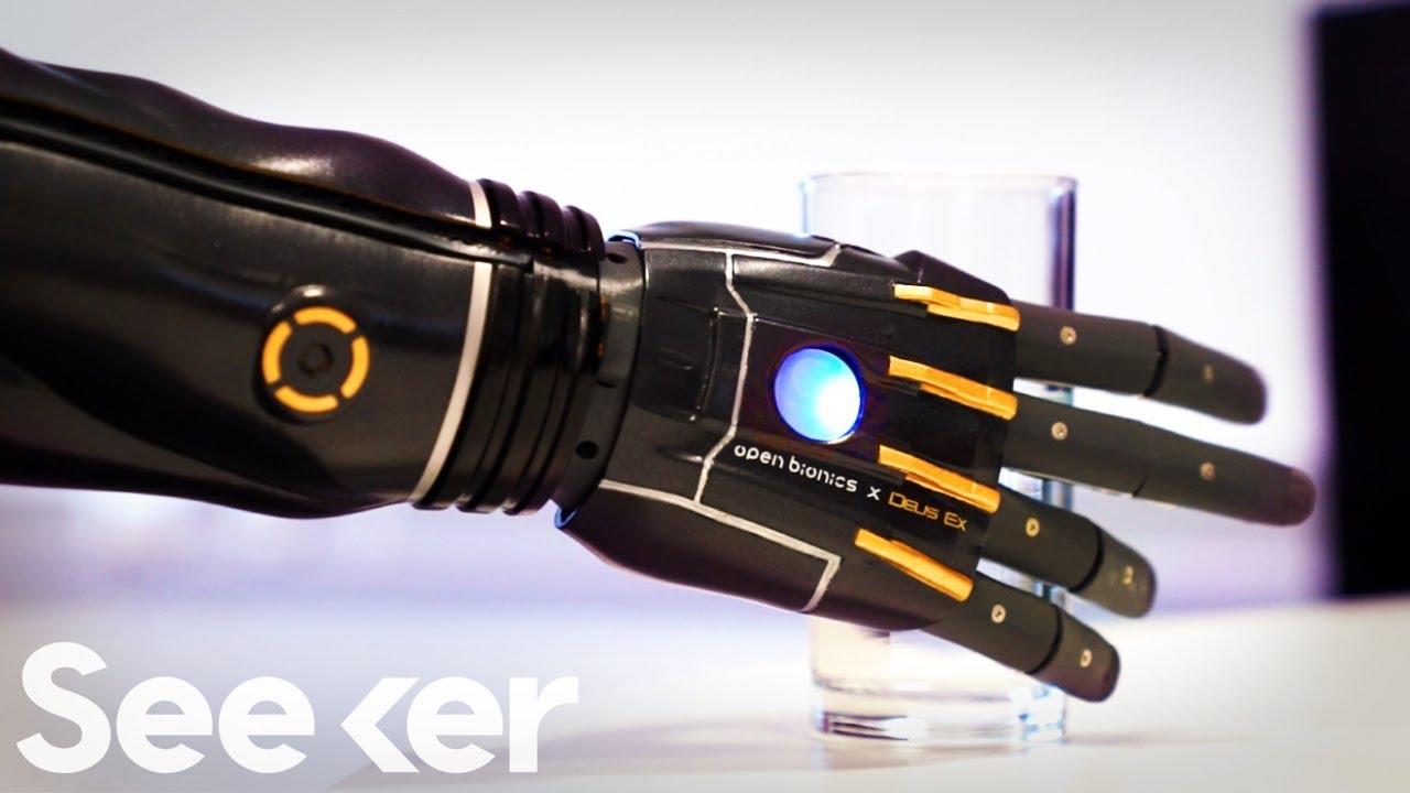 Prosthetic Arm