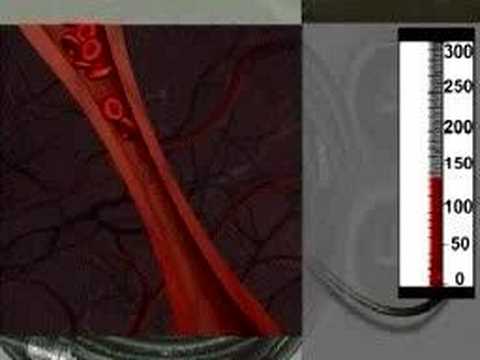 Blood Pressure Youtube
