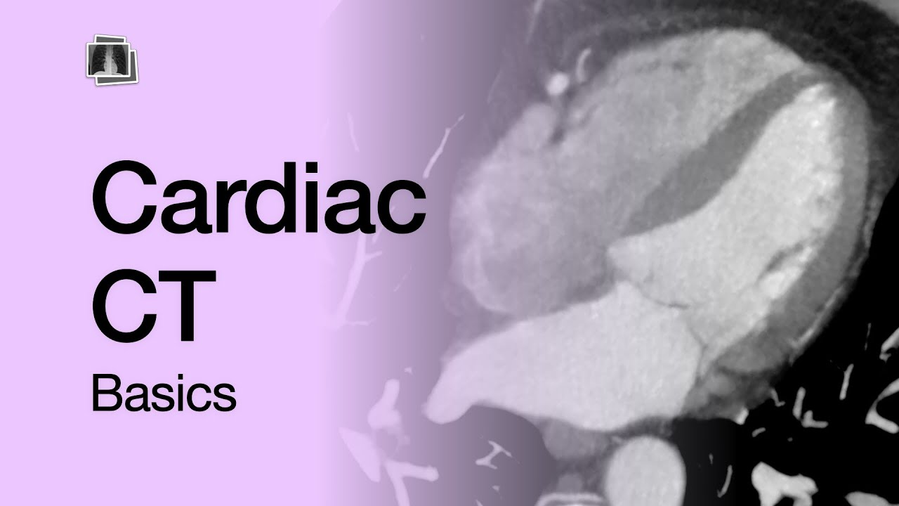 Cardiac Ct Basics Youtube