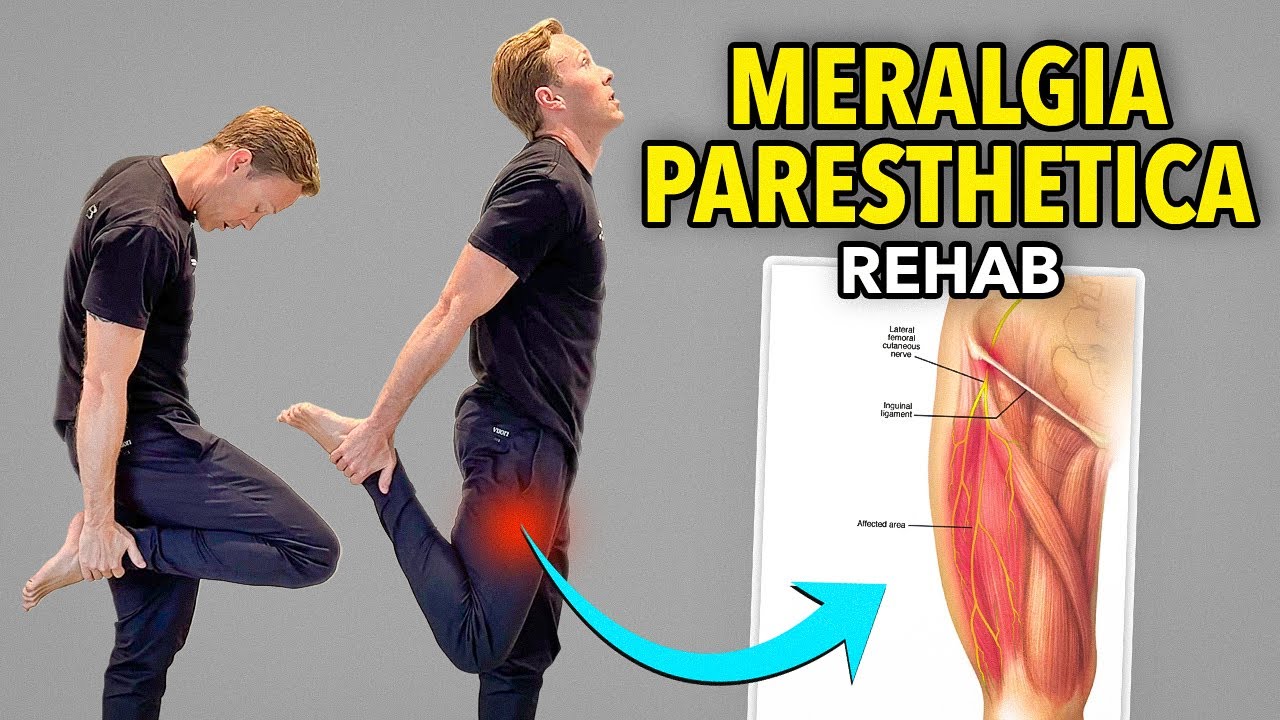 3 Femoral Nerve Exercises Meralgia Paresthetica Youtube