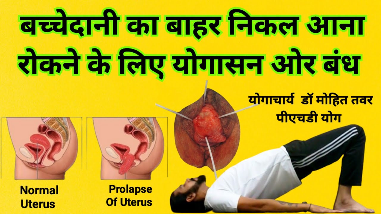 Yoga For Uterus Problem बच च द न क ब हर ख सक आन Prolapse Of