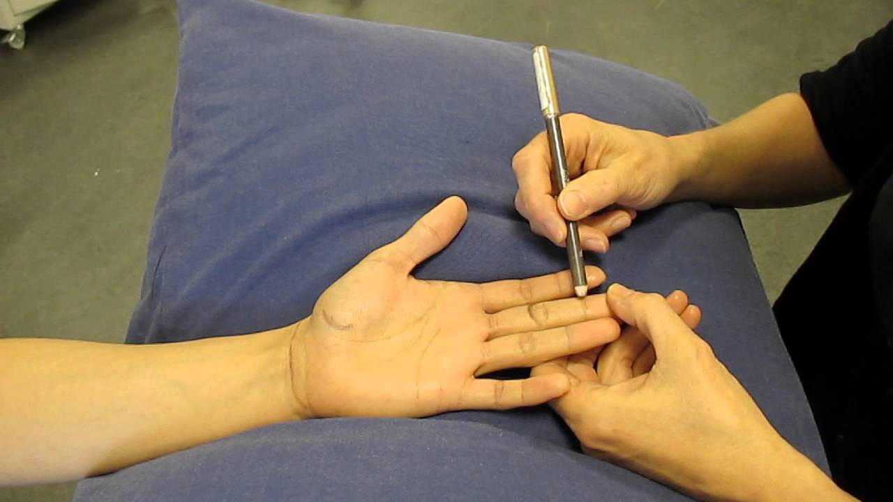Interphalangeal Joint Palmar Aspect Hand Palpation Youtube