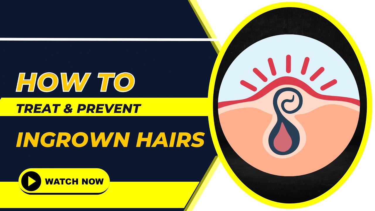 Best Hair Removal To Prevent Ingrown Hairs At Hayden Ness Blog