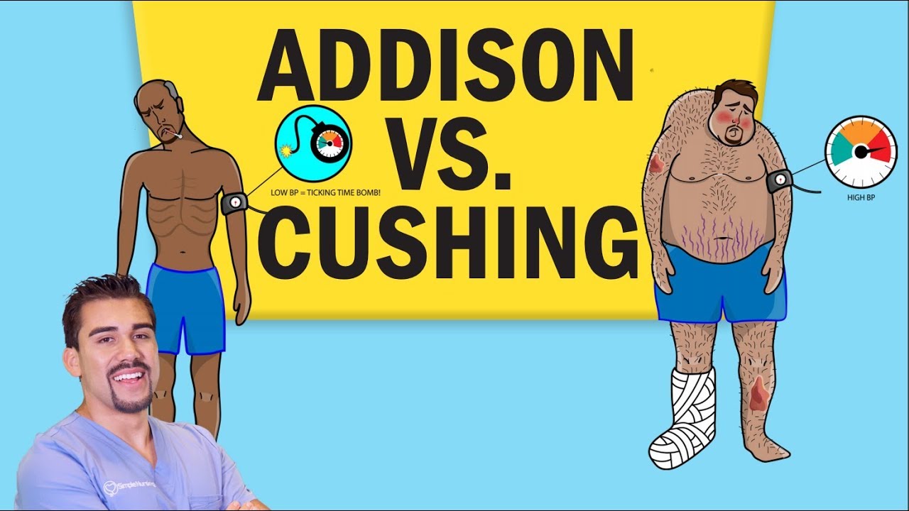 Addison S Disease Vs Cushing S Syndrome Pregnant Health Tips