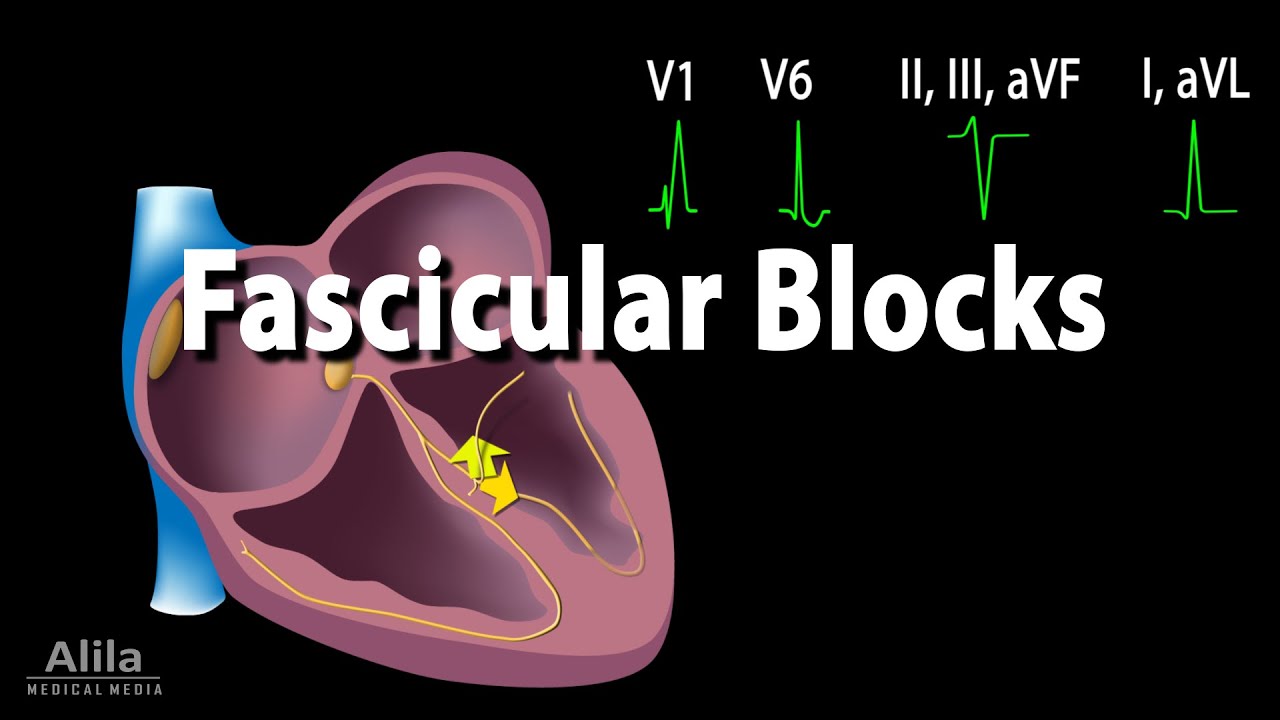 Fascicular Blocks Animation Youtube