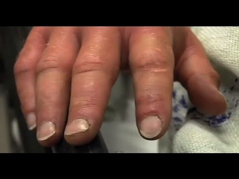 Snake Bite Part 1 Bizarre Er Youtube