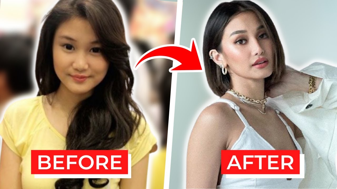 Philippine Celebrities Without Makeup Before And After Plastic Surgery