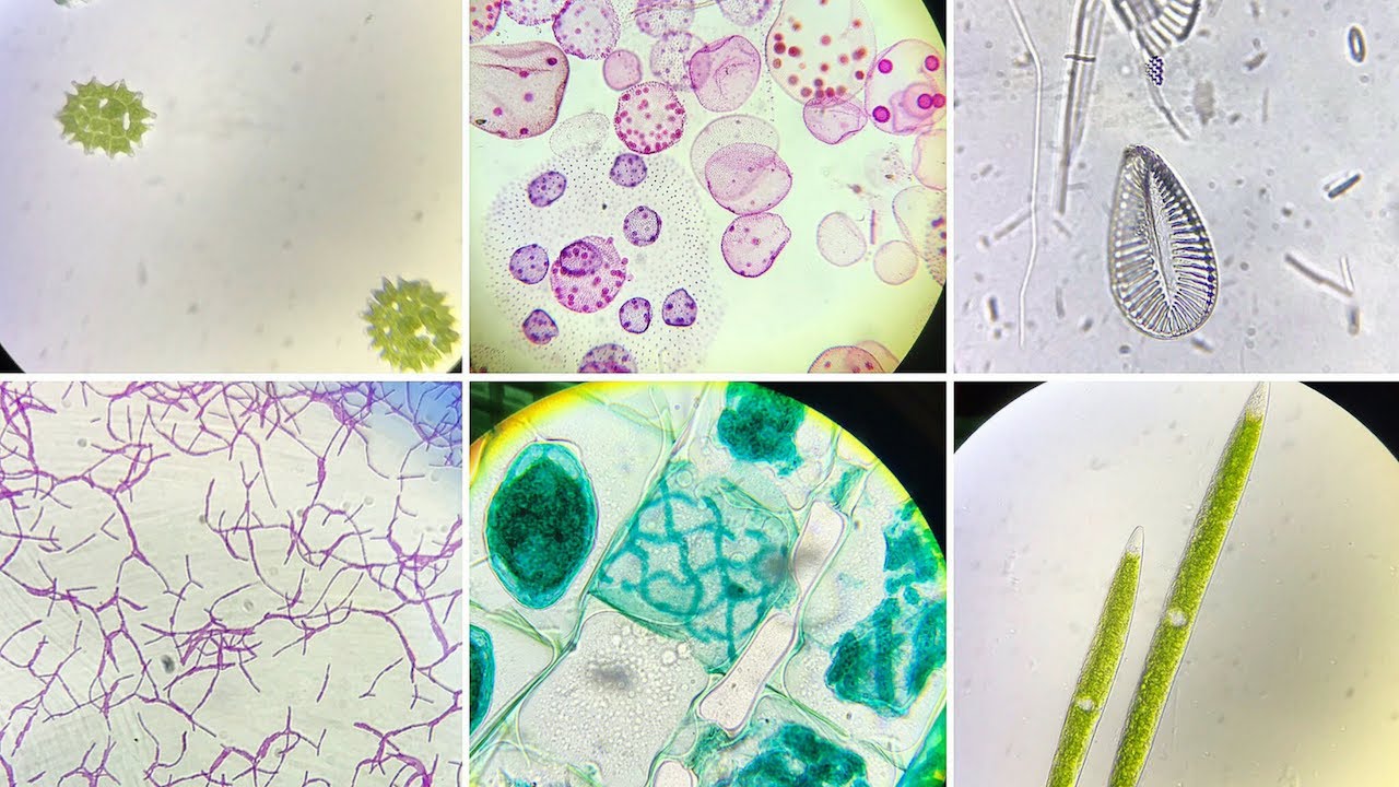 Unicellular Algae Microscope
