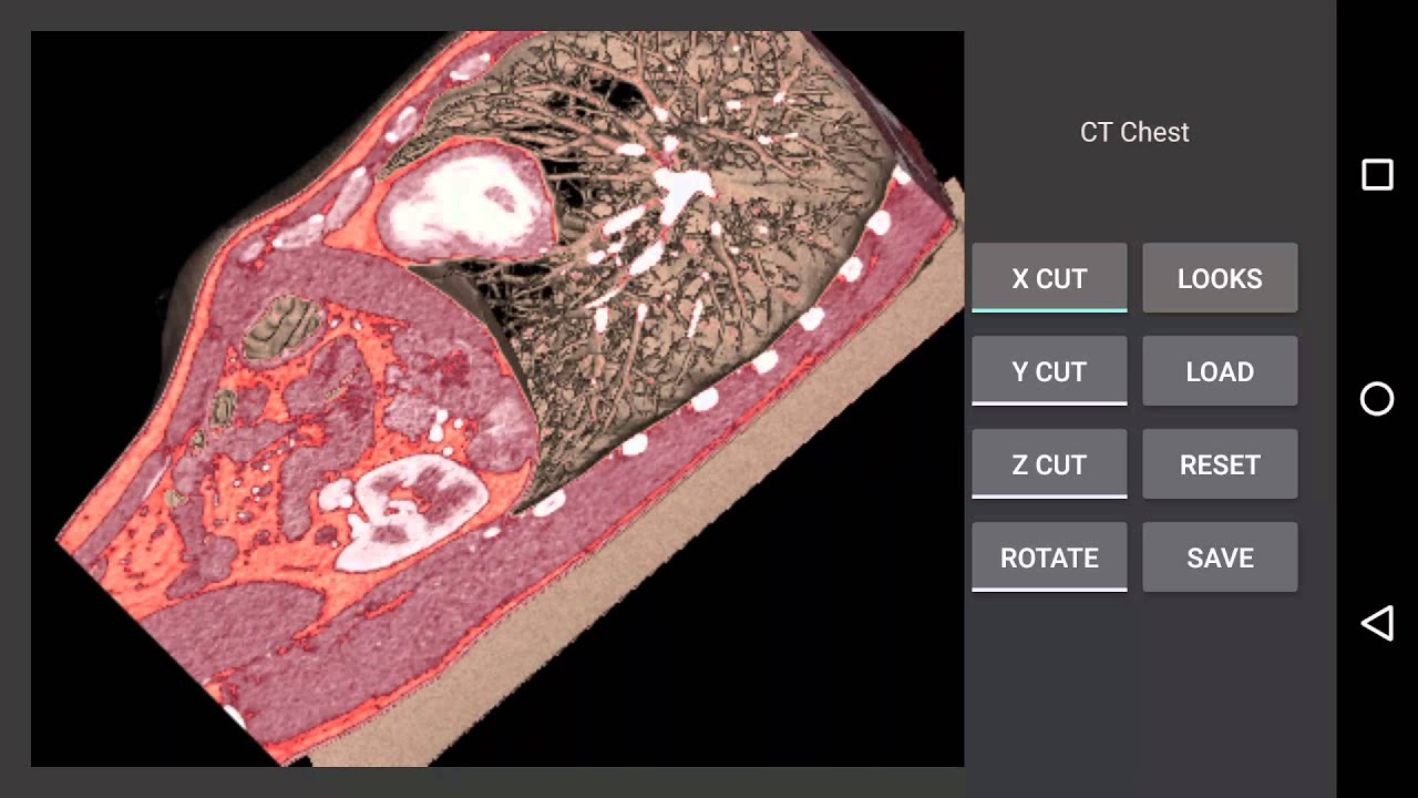 Volume Rendering Youtube